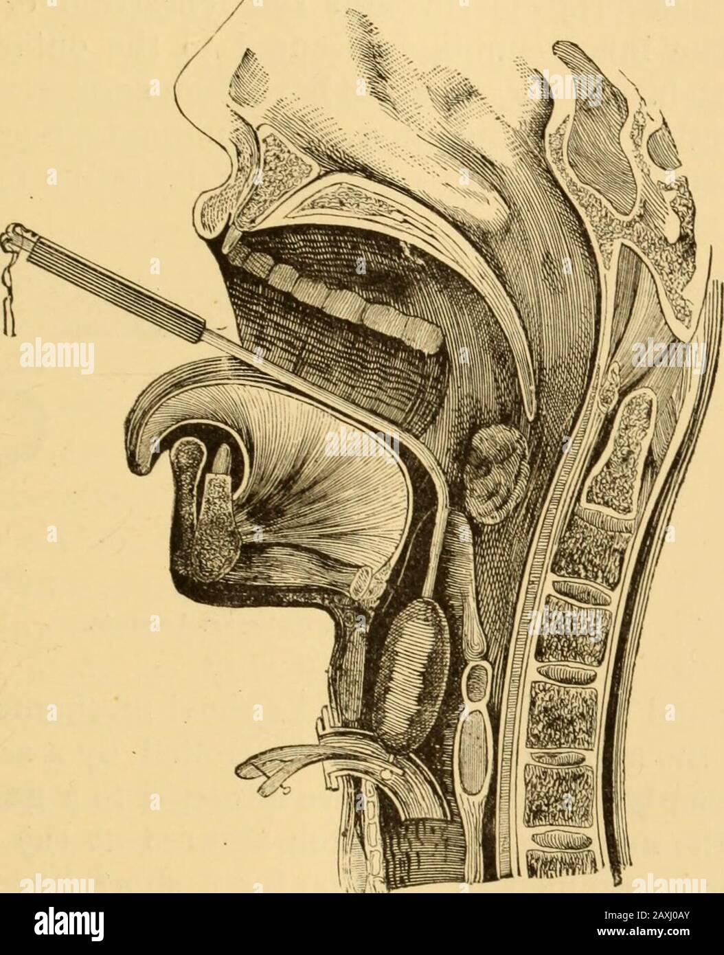 Laringe e trachea hi-res stock photography and images - Alamy