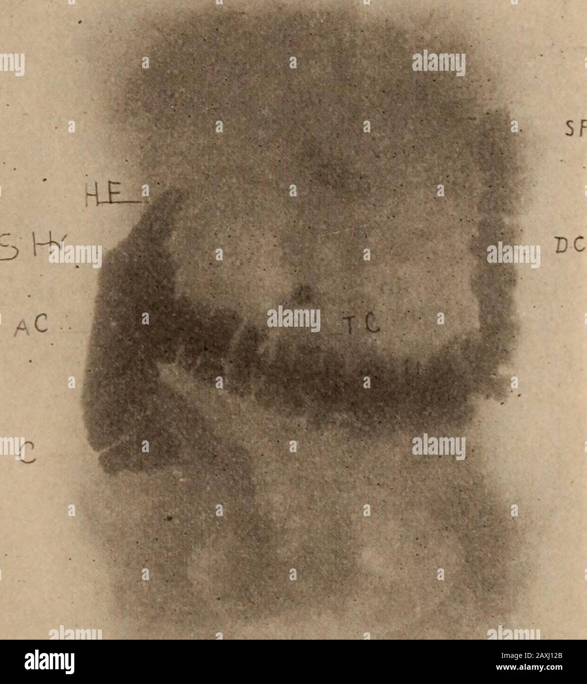 Moids hi-res stock photography and images - Alamy