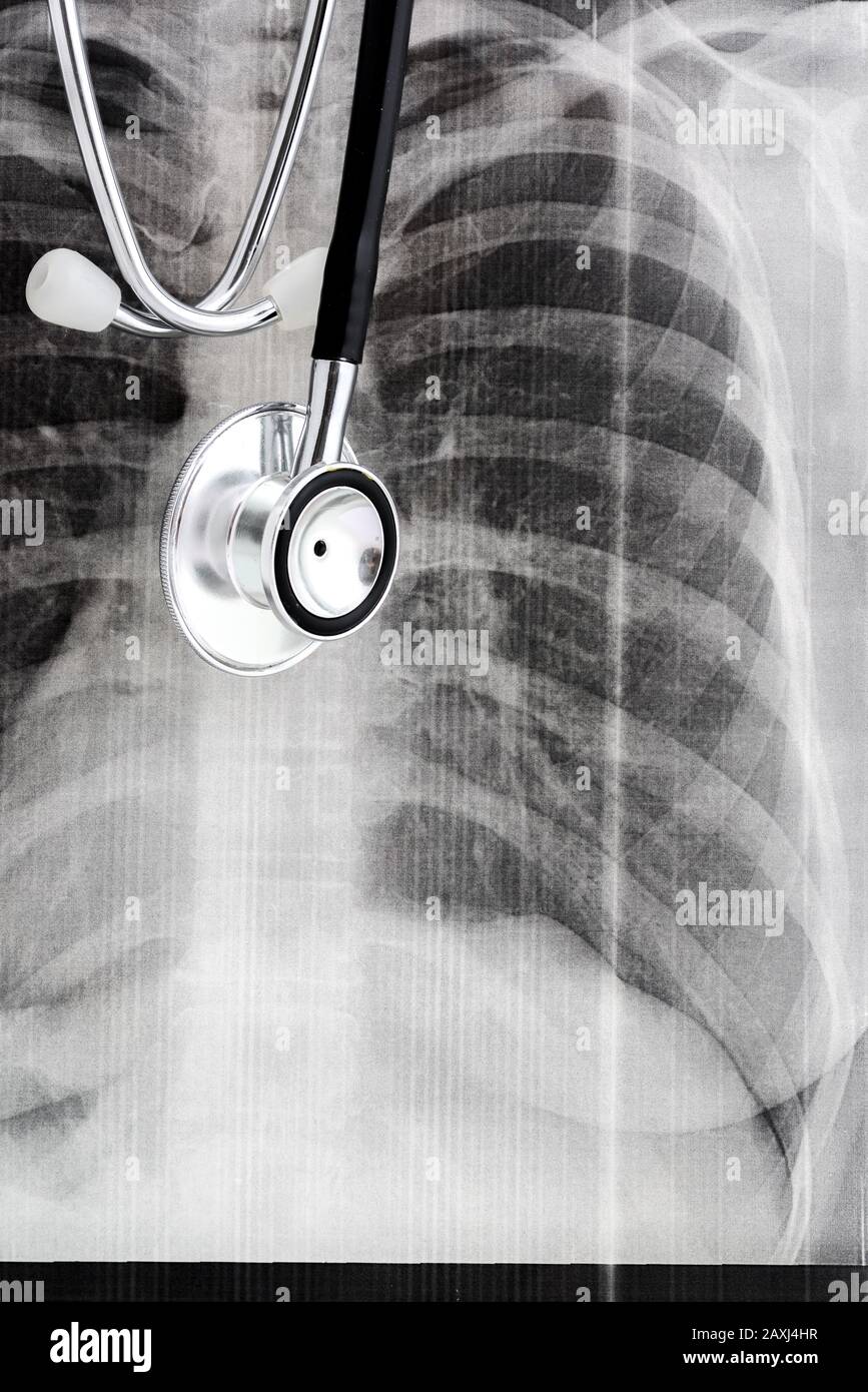 Pneumonia virus stethoscope medicine lung snapshot close up Stock Photo ...