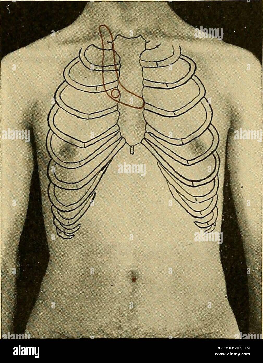 Cardiac apex hi-res stock photography and images - Alamy