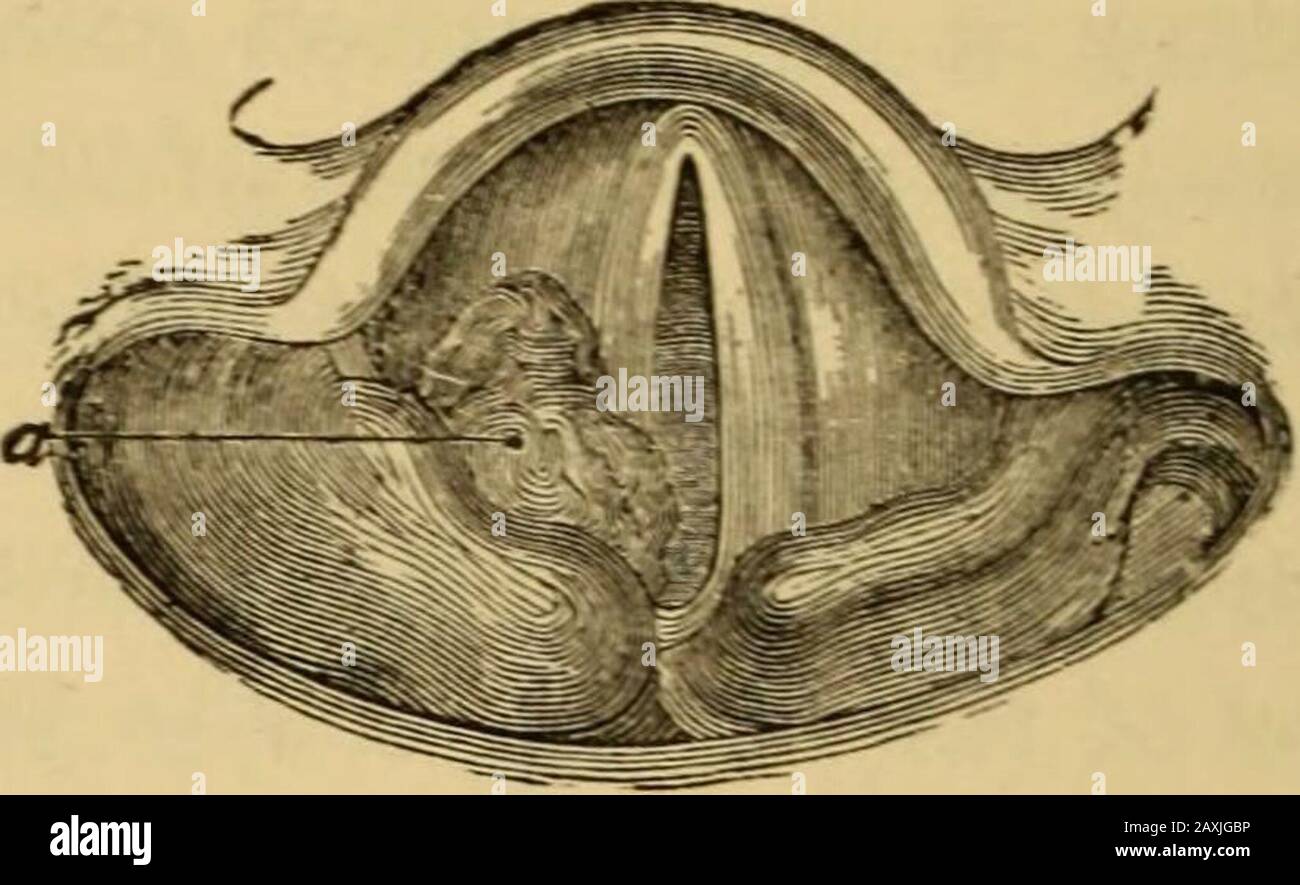 Diseases of the throat and nasal passages; a guide to the diagnosis and ...