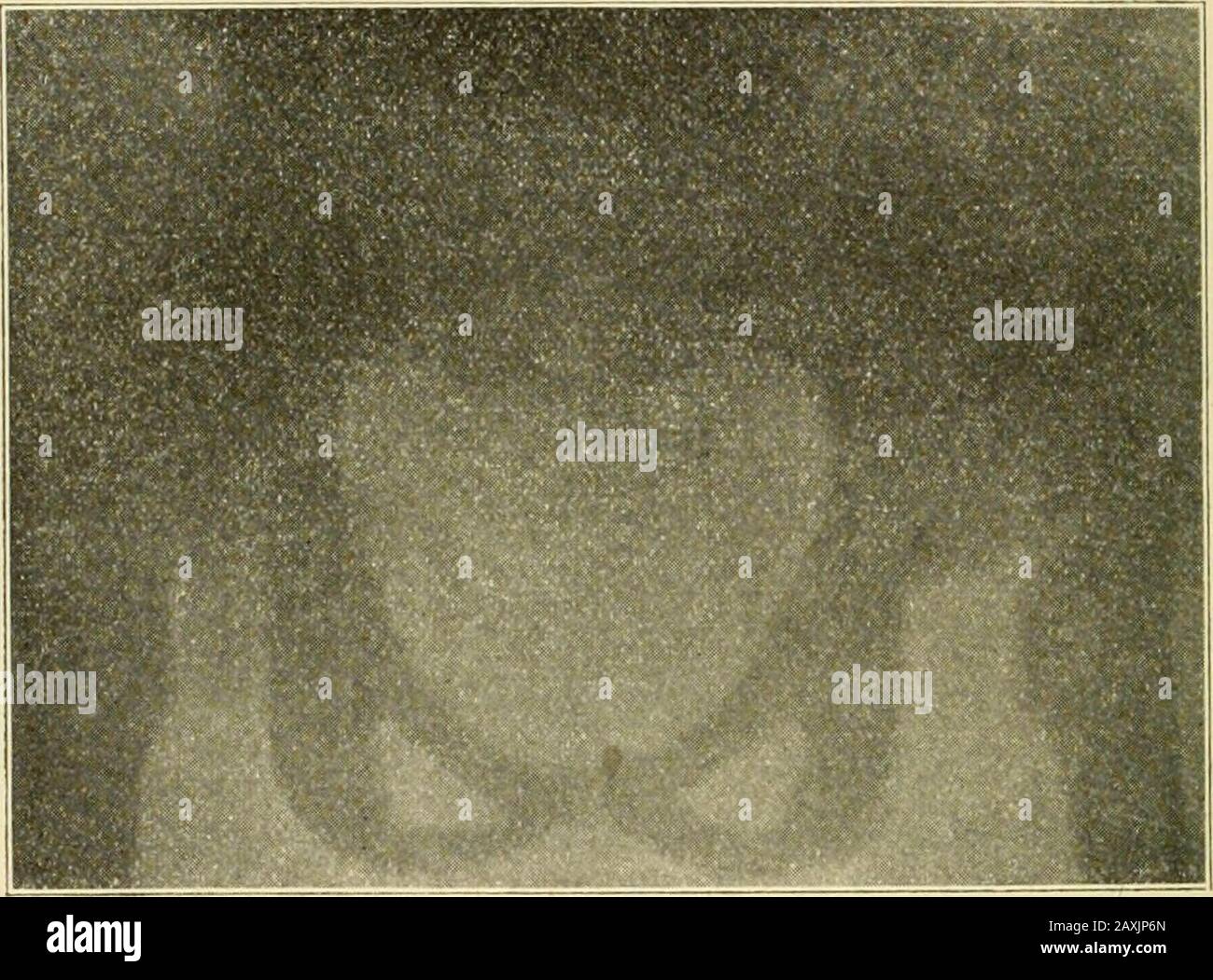 Kniegelenke hi-res stock photography and images - Alamy