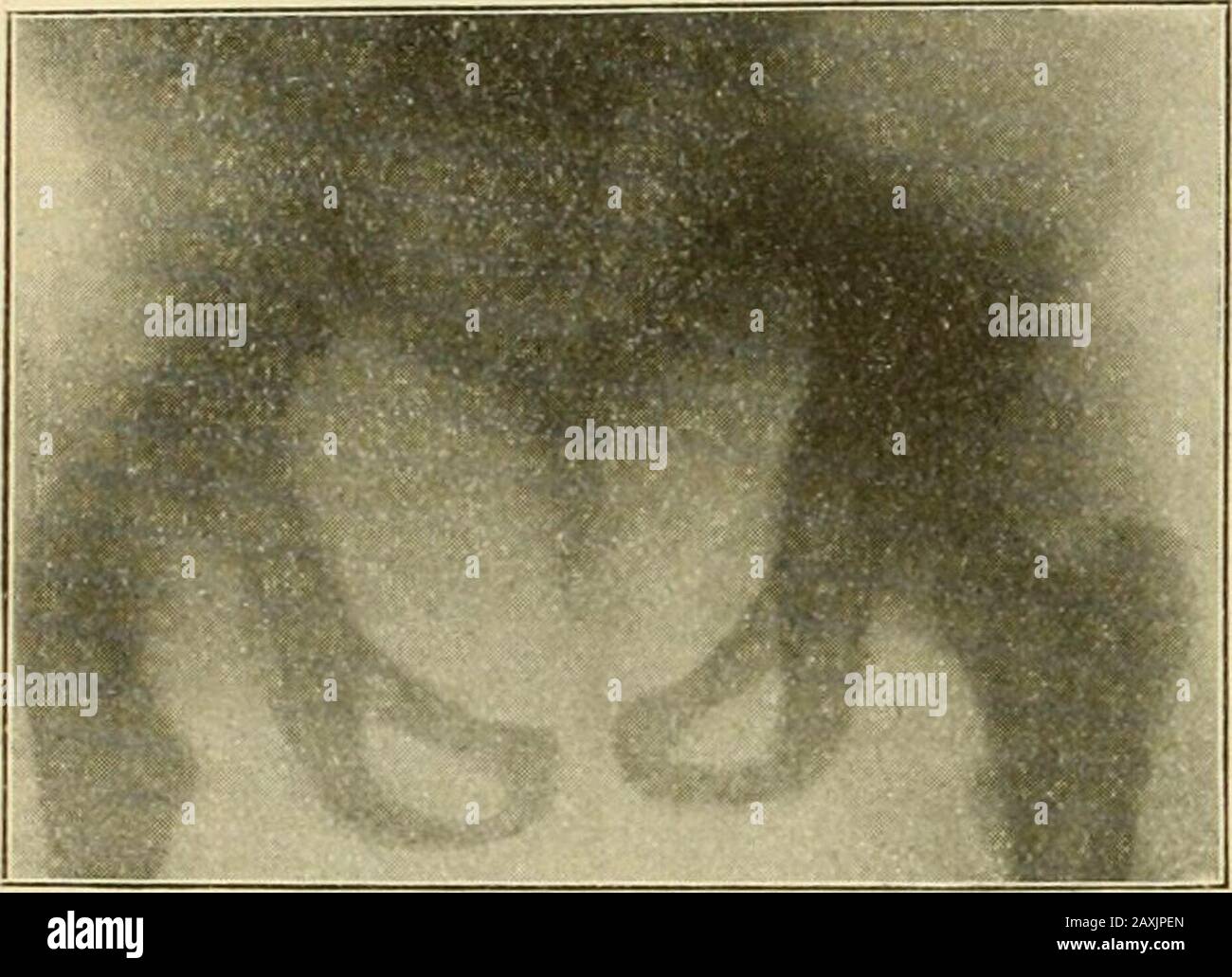 Rontgenbild hi-res stock photography and images - Alamy