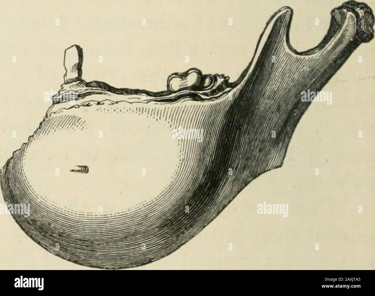 Injuries and diseases of the jaws . projecting from the wall. The case ...