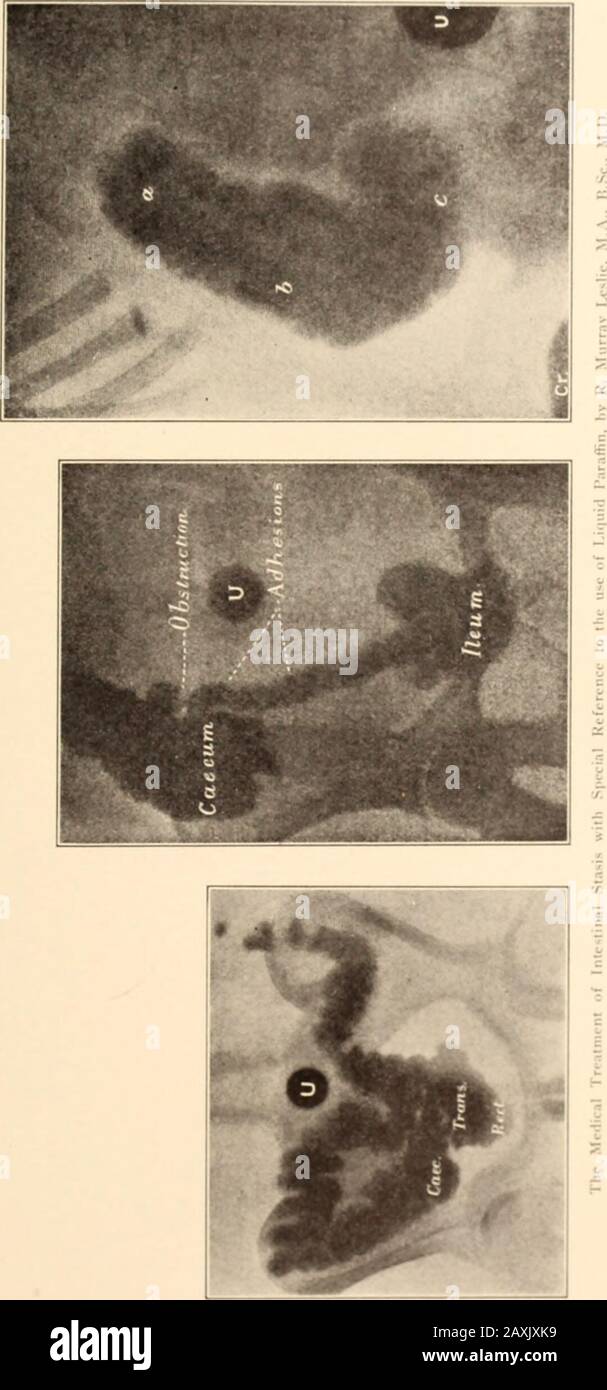 Normal u shaped hi-res stock photography and images - Alamy