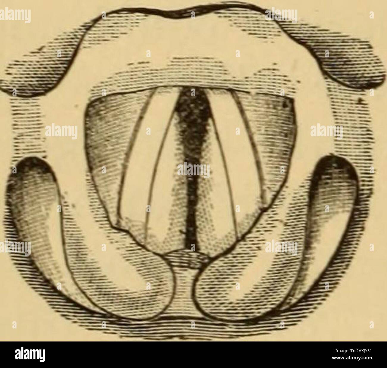 Acute laryngitis hi-res stock photography and images - Alamy