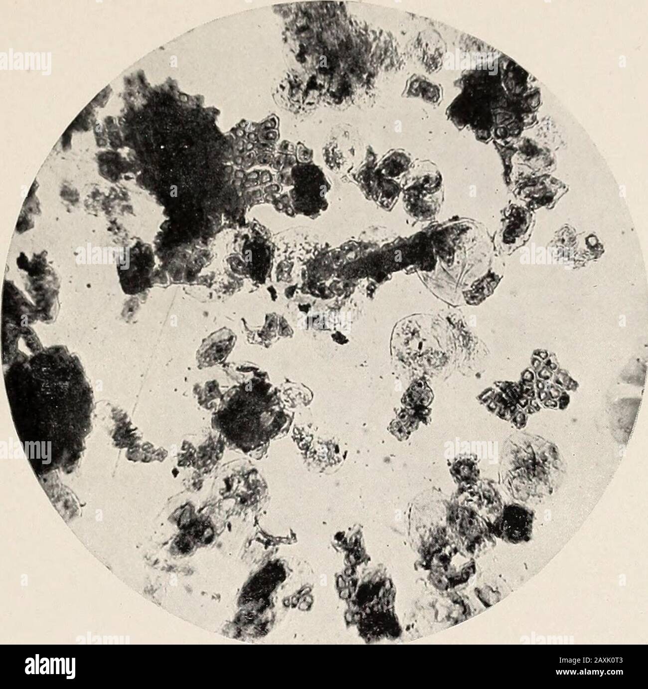 Microscopical examination hi-res stock photography and images - Alamy