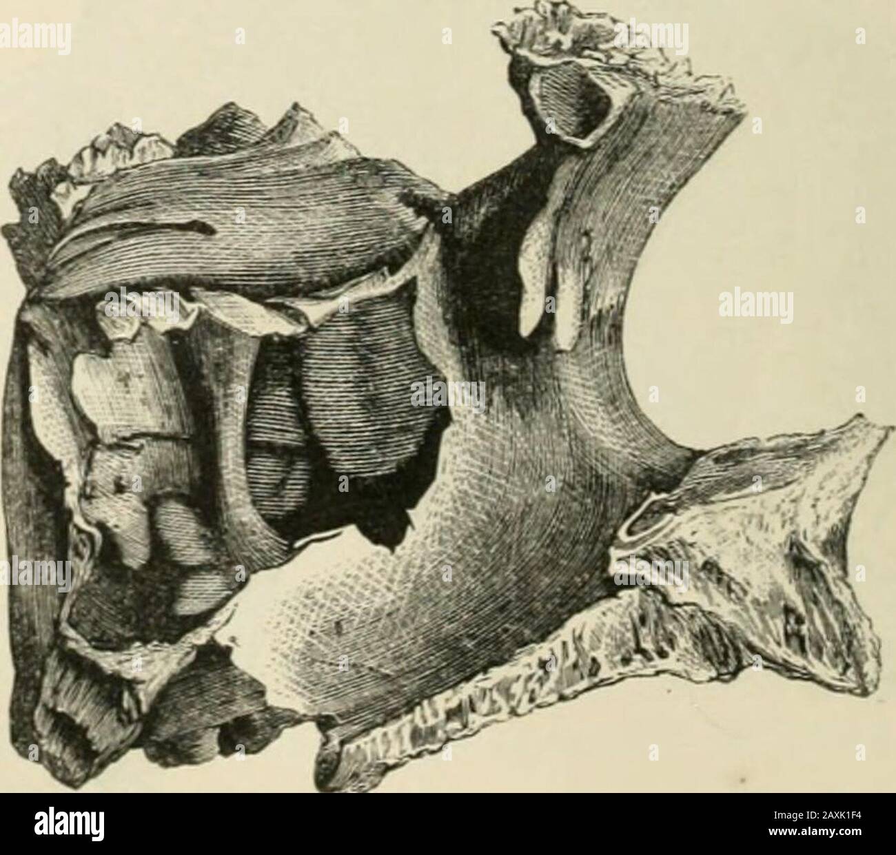 Injuries and diseases of the jaws . so that ordinarily there is only a ...