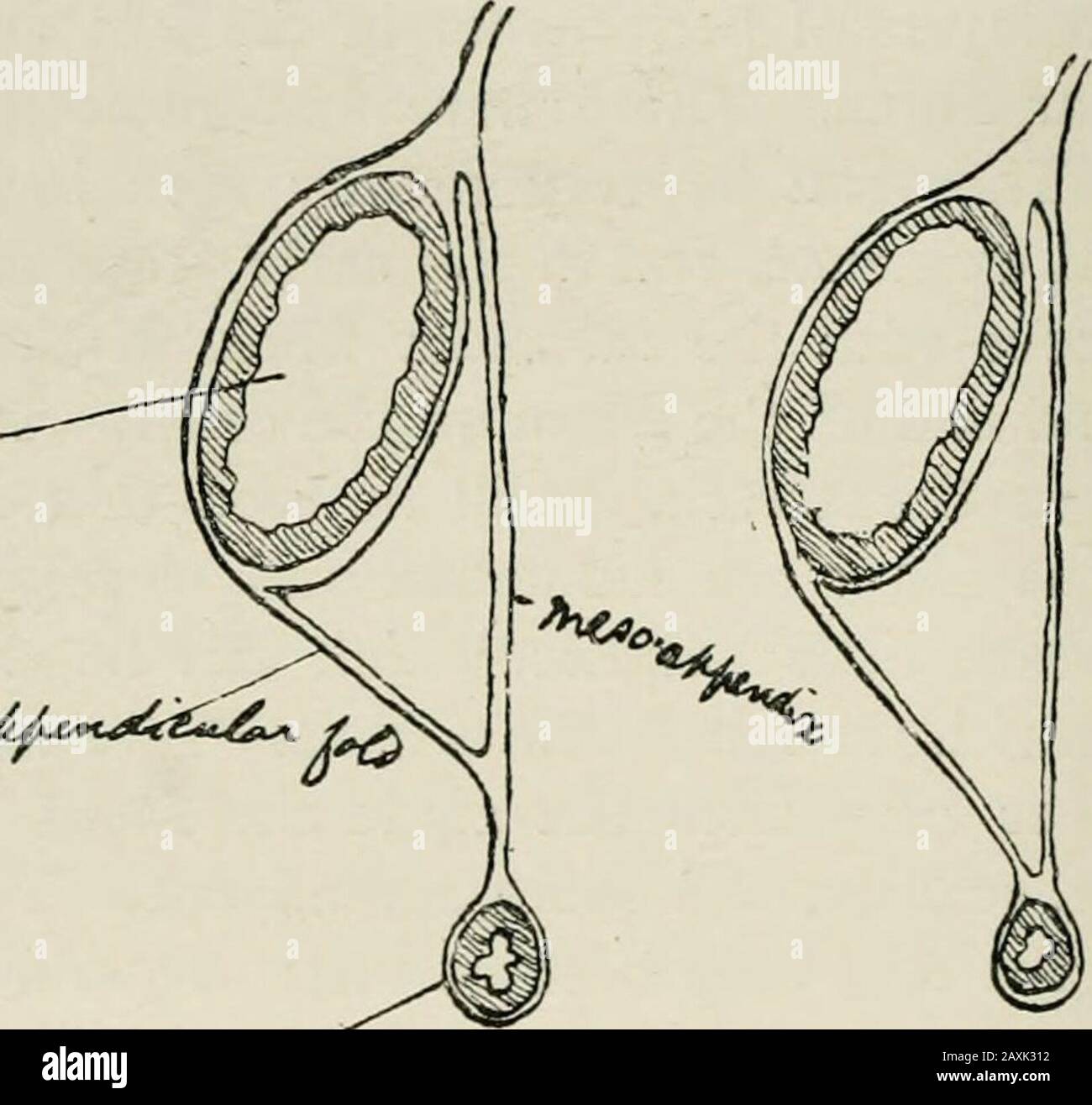 On retro-peritoneal hernia . s position isprevented. To the importance ...