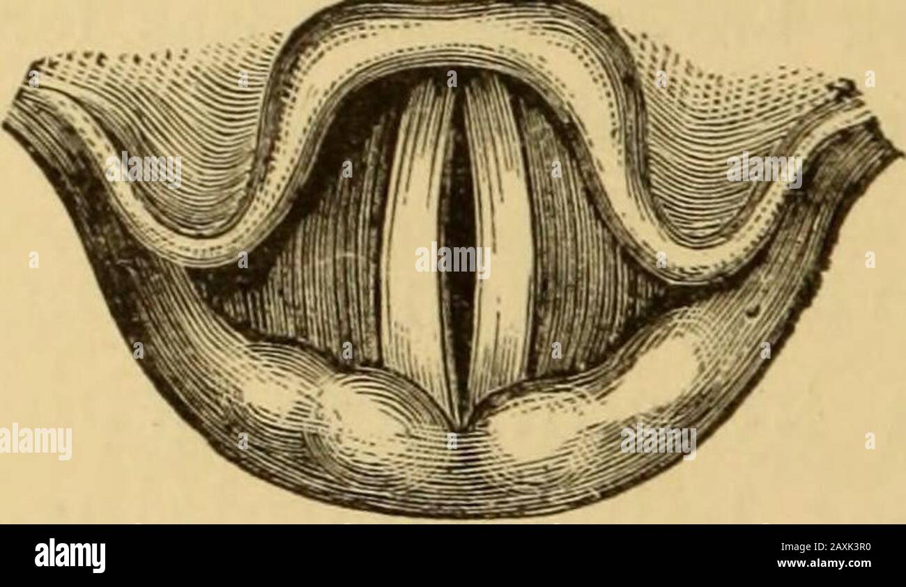 Diseases of the throat and nasal passages; a guide to the diagnosis and ...