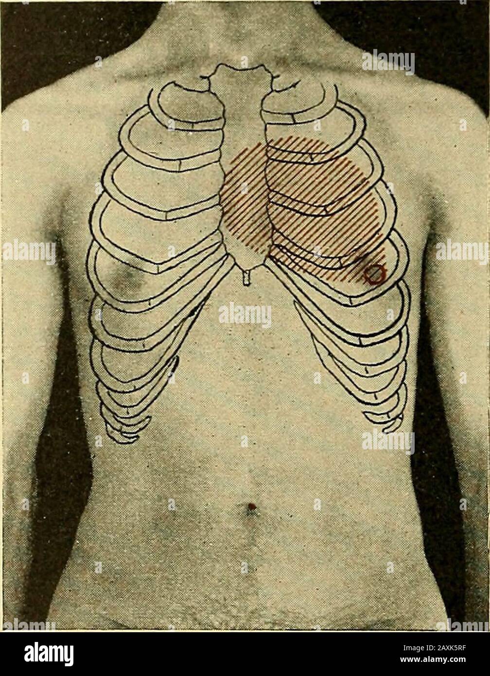 Diseases of the heart and arterial system : designed to be a practical ...