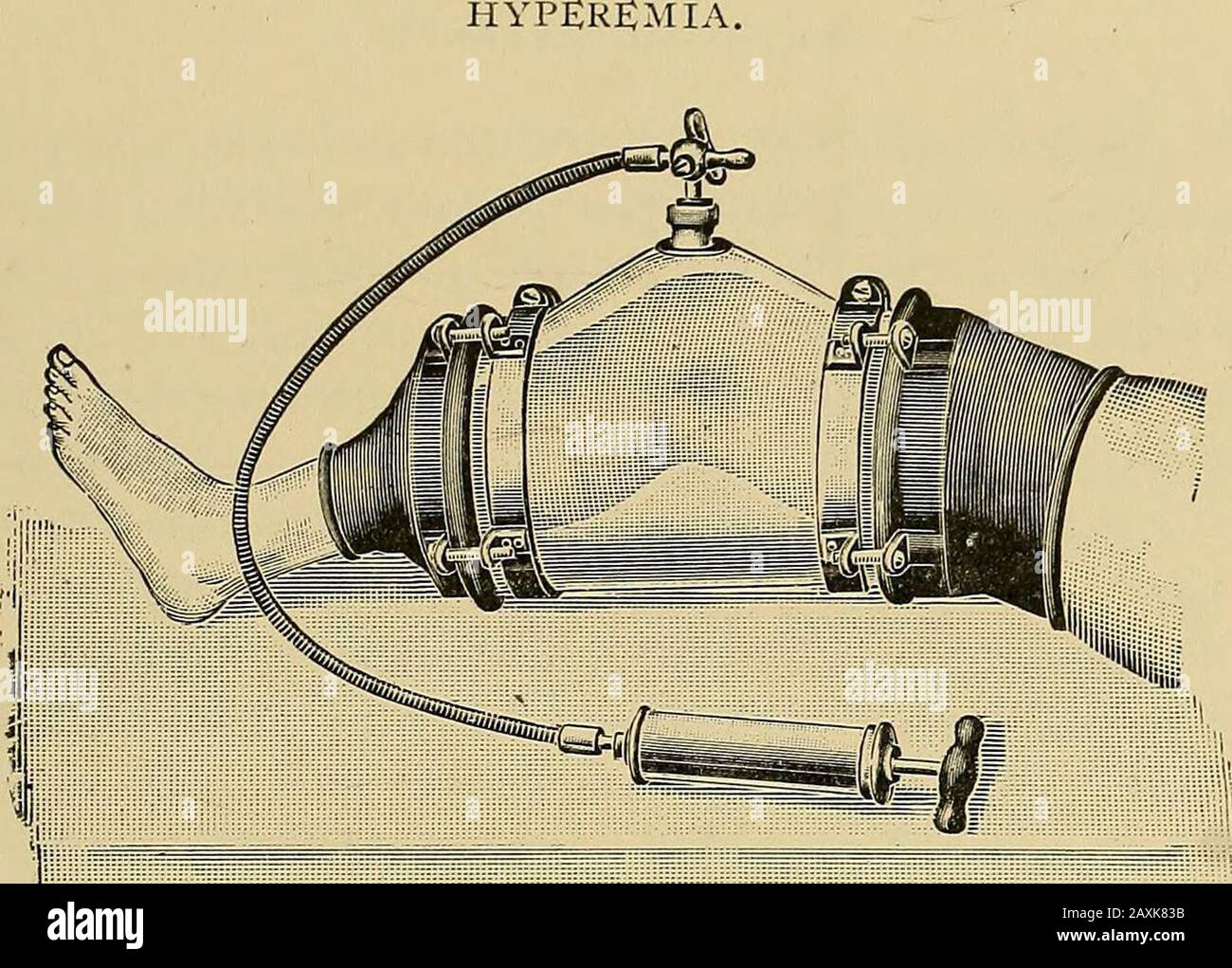 Rational therapy . nd when auxiliary apparatusis introduced for ...