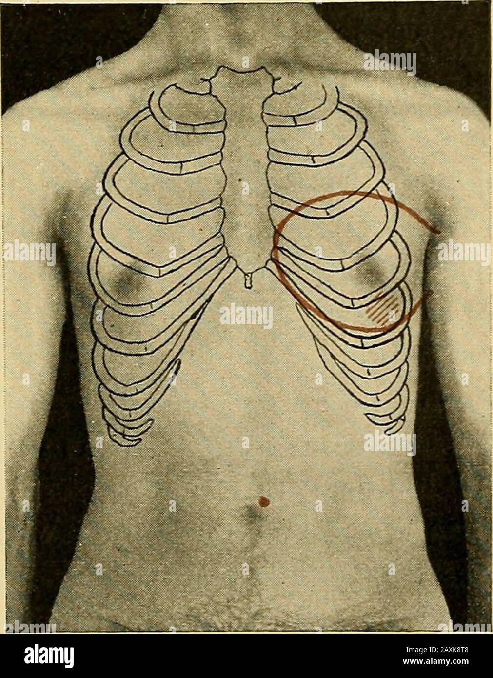Epigastrium hi-res stock photography and images - Alamy