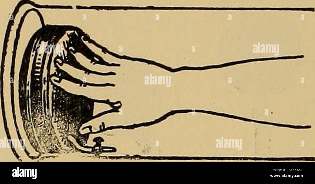 Rational therapy . Figure 5—No. 3 Position of the hand against the ...