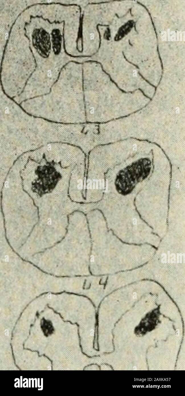 The Journal of nervous and mental disease . ^. ;- * 1 U#s Fig. i ...