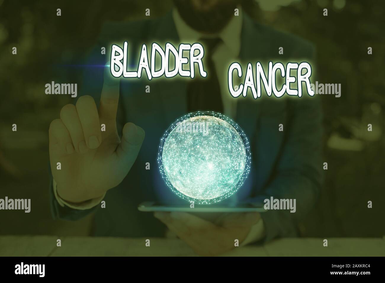 Text sign showing Bladder Cancer. Business photo showcasing form of ... Text sign showing Bladder Cancer. Business photo showcasing form of ...