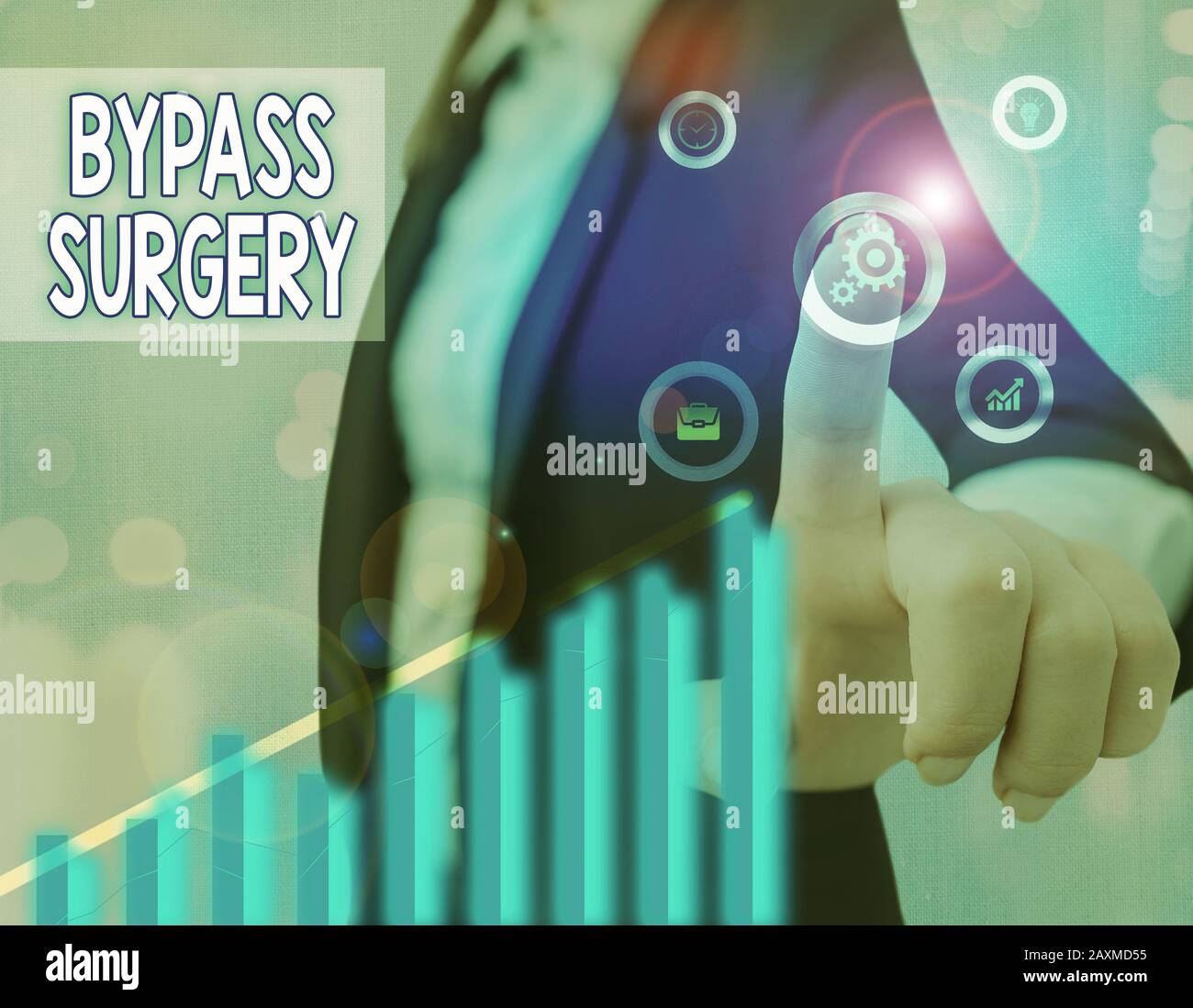 Text sign showing Bypass Surgery. Business photo text type of surgery ...