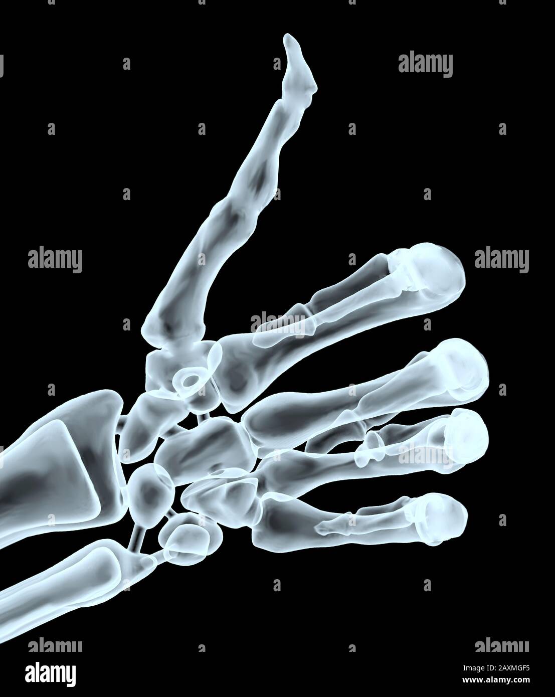 Xray hand hi-res stock photography and images - Alamy