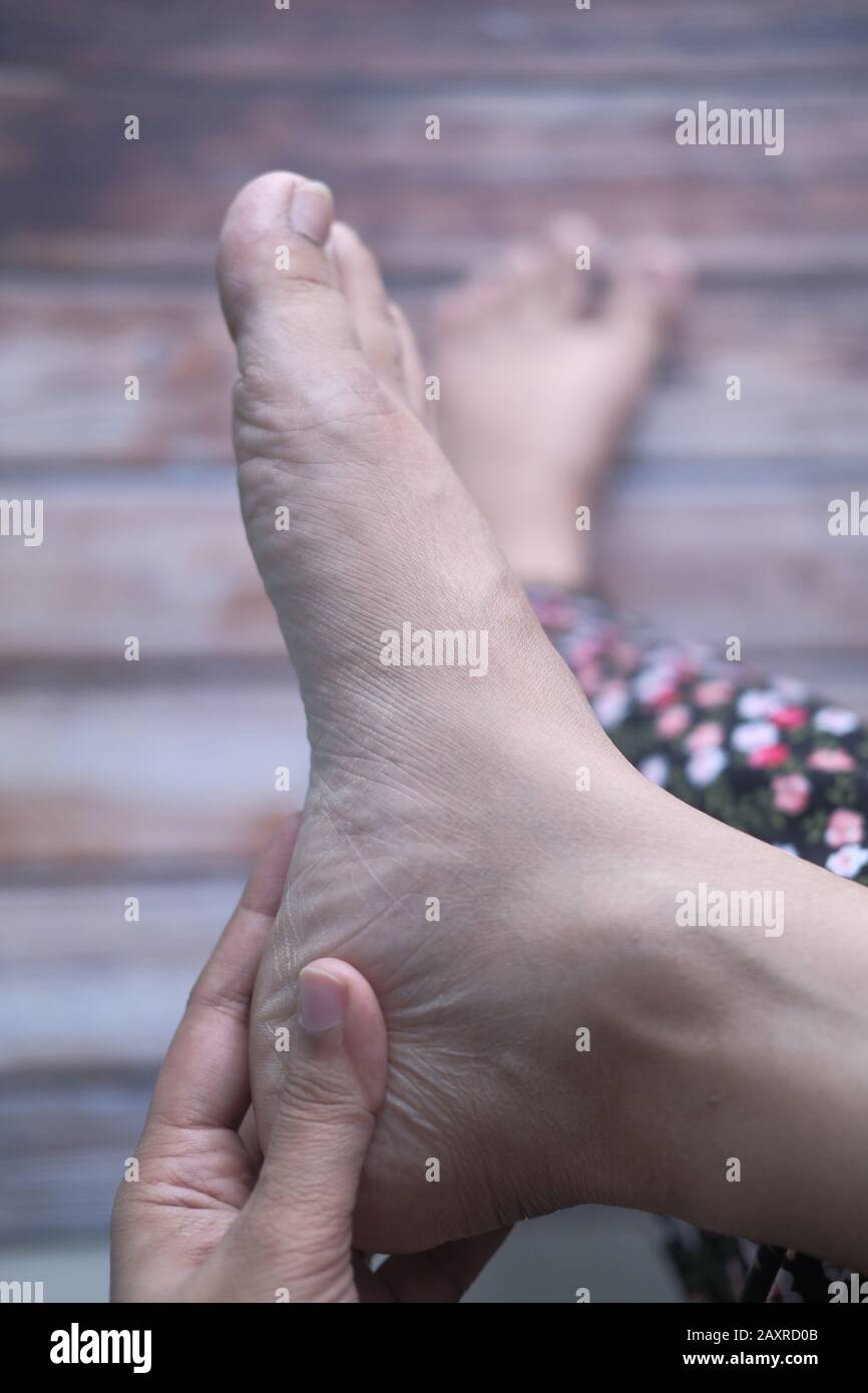 Closeup of women touching toes and suffering feet pain Stock Photo - Alamy