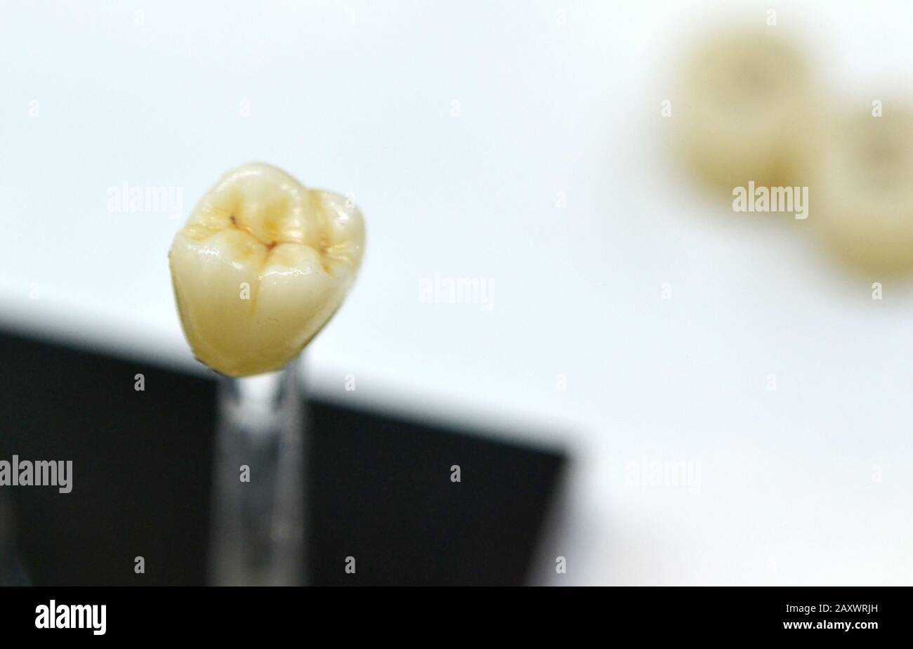 several models artificial human dental crown close-up Stock Photo - Alamy