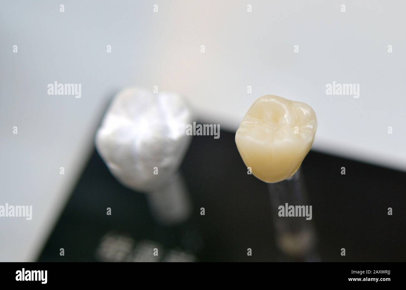 several models artificial human dental crown close-up Stock Photo - Alamy