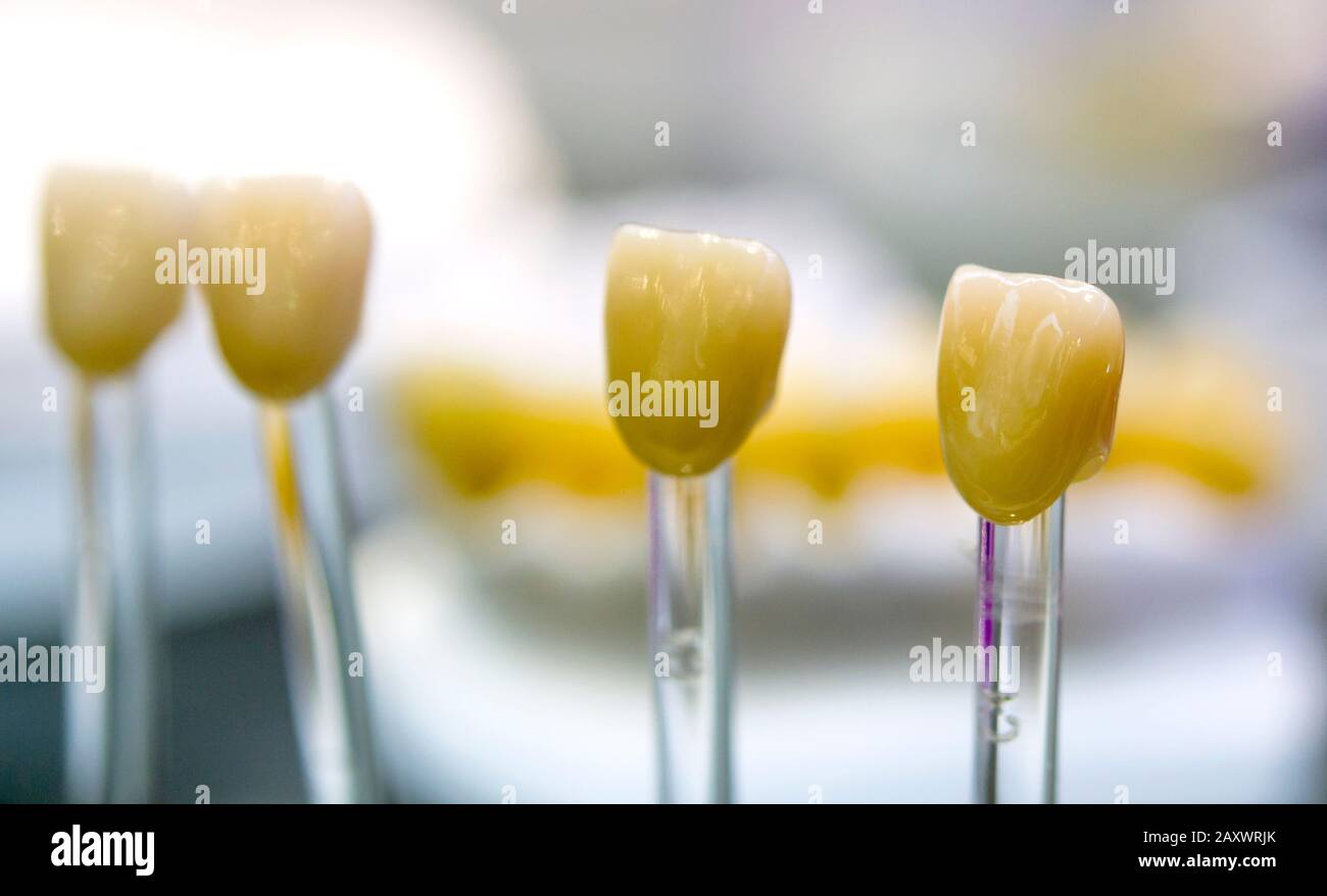 several models artificial human dental crown close-up Stock Photo - Alamy