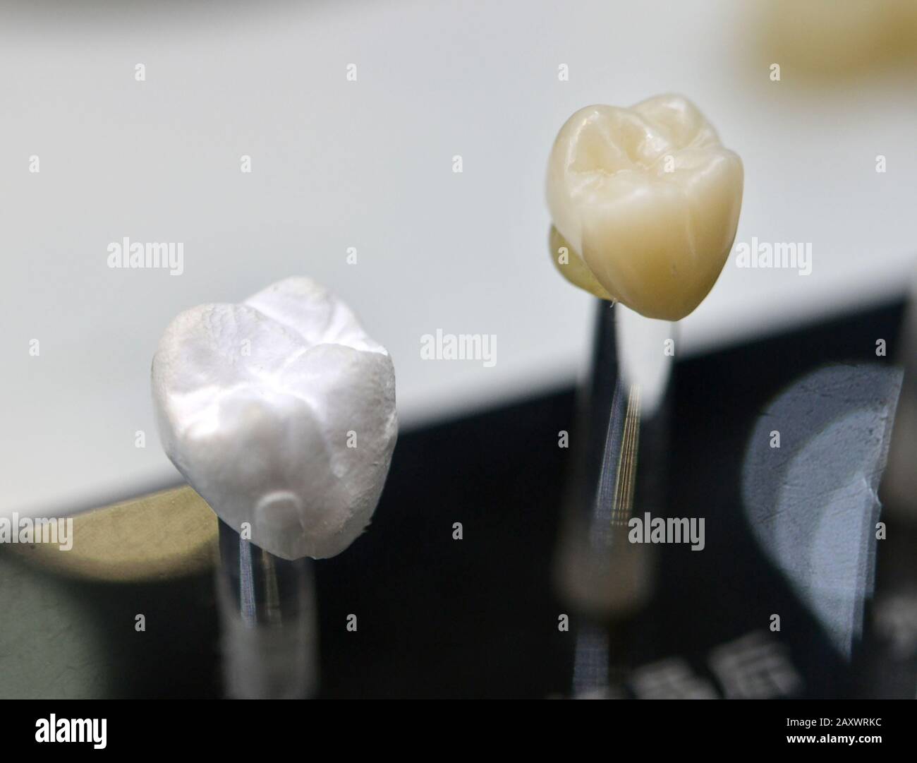 Dental crown hi-res stock photography and images - Alamy