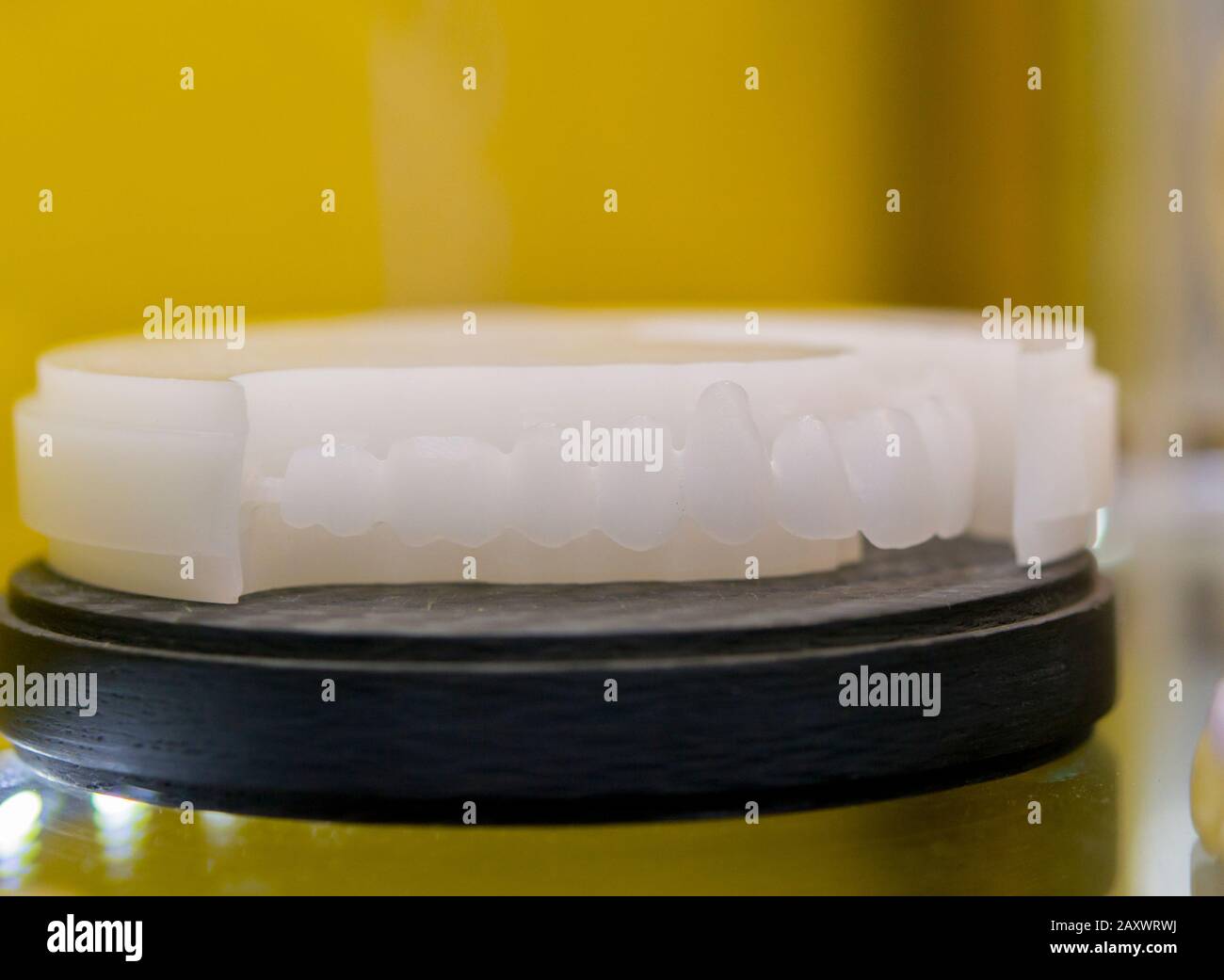 carved teeth with a milling machine cad cam close-up Stock Photo - Alamy