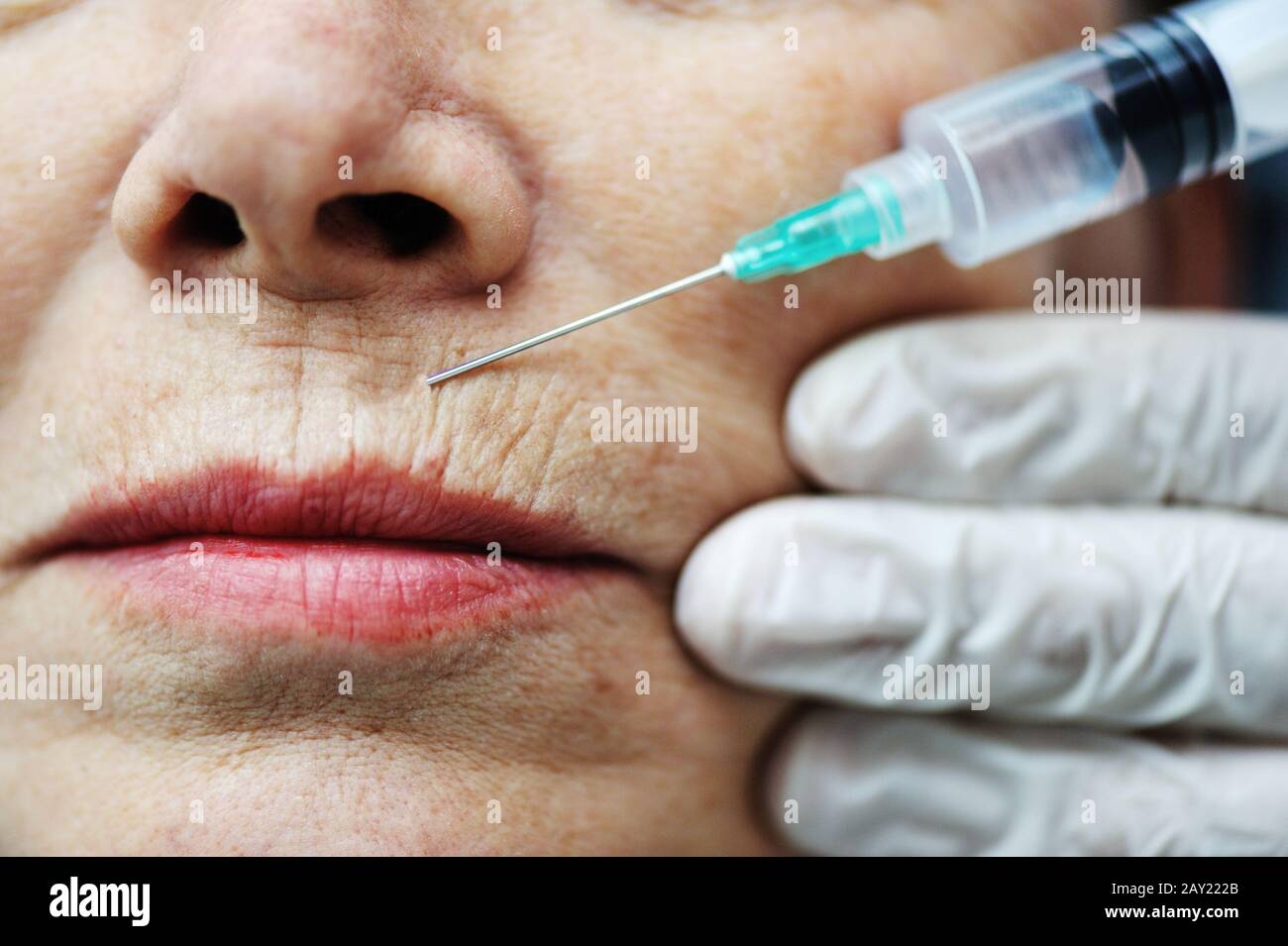 Elderly woman getting Botox injection procedure Stock Photo - Alamy