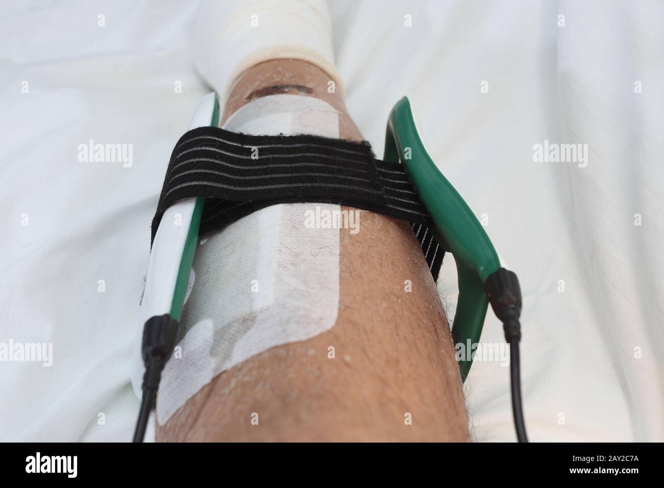 magnetotherapy - sinusoids applied on the leg fracture Stock Photo - Alamy