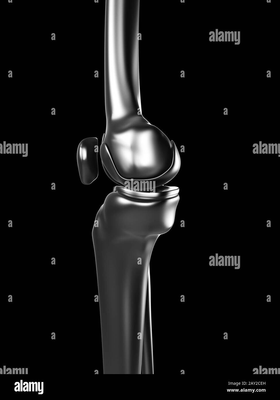 3d rendered illustration - metal knee Stock Photo - Alamy