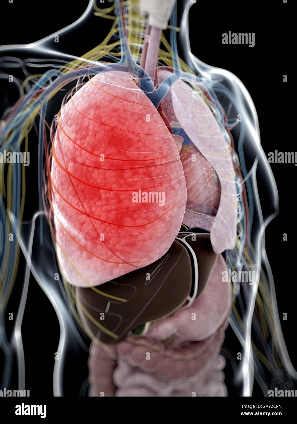 3d rendered illustration of pneumonia Stock Photo - Alamy