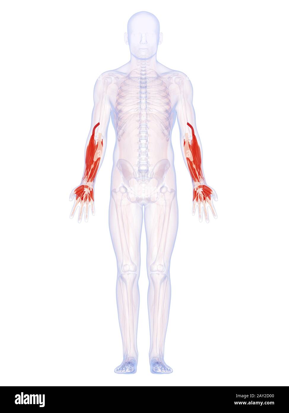 Lower Arm Muscle Pain