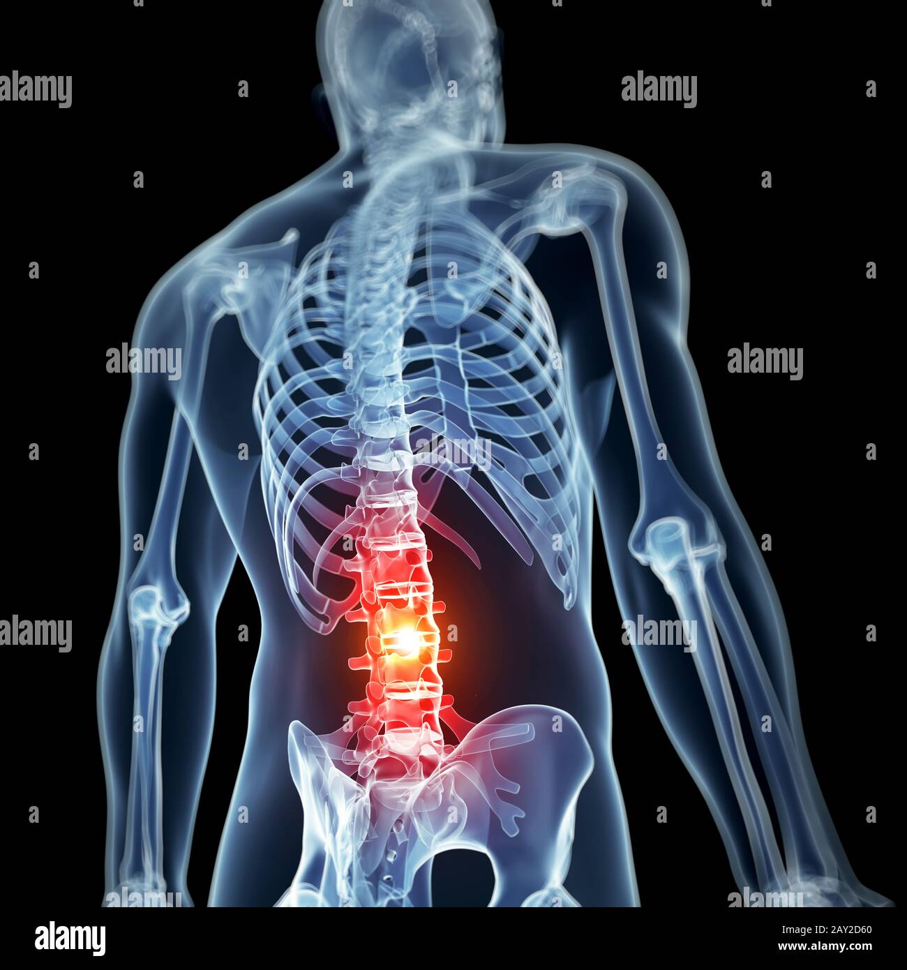 3d rendered illustration - backache Stock Photo - Alamy