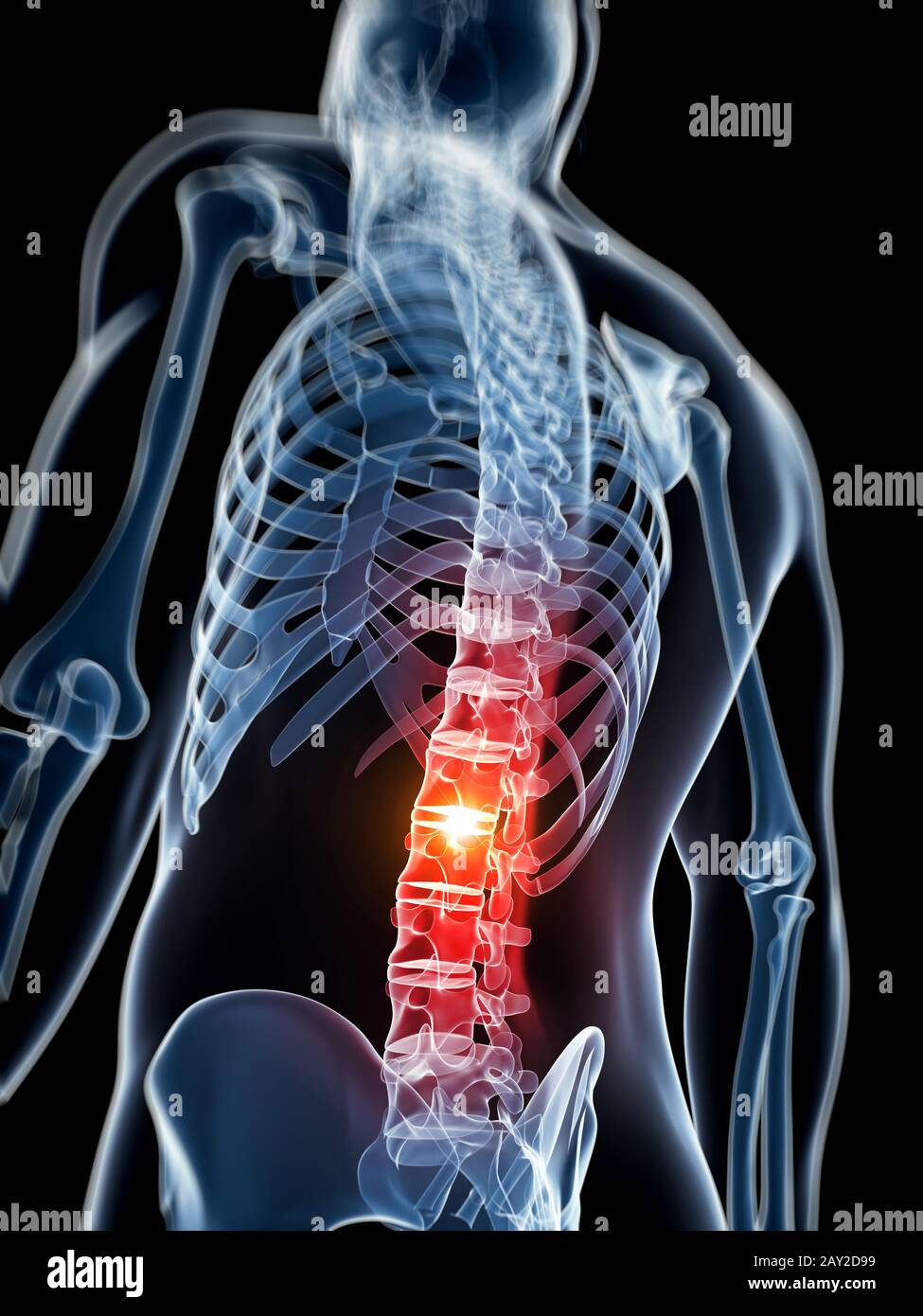 3d rendered illustration - backache Stock Photo - Alamy