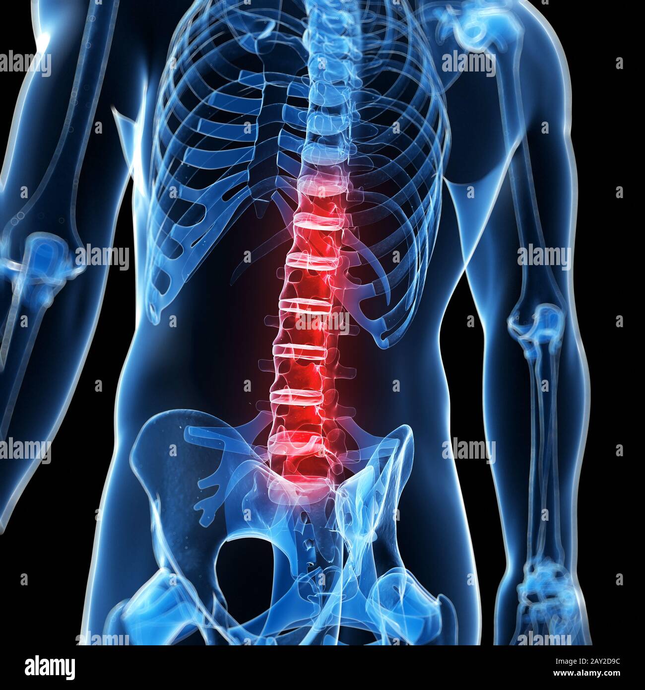 3d rendered illustration of a painful back Stock Photo - Alamy