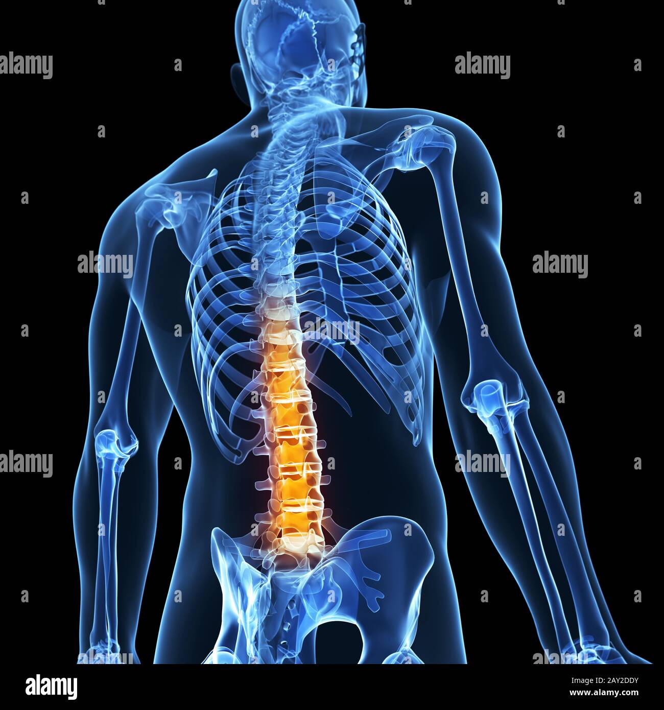 3d rendered illustration of a painful back Stock Photo - Alamy