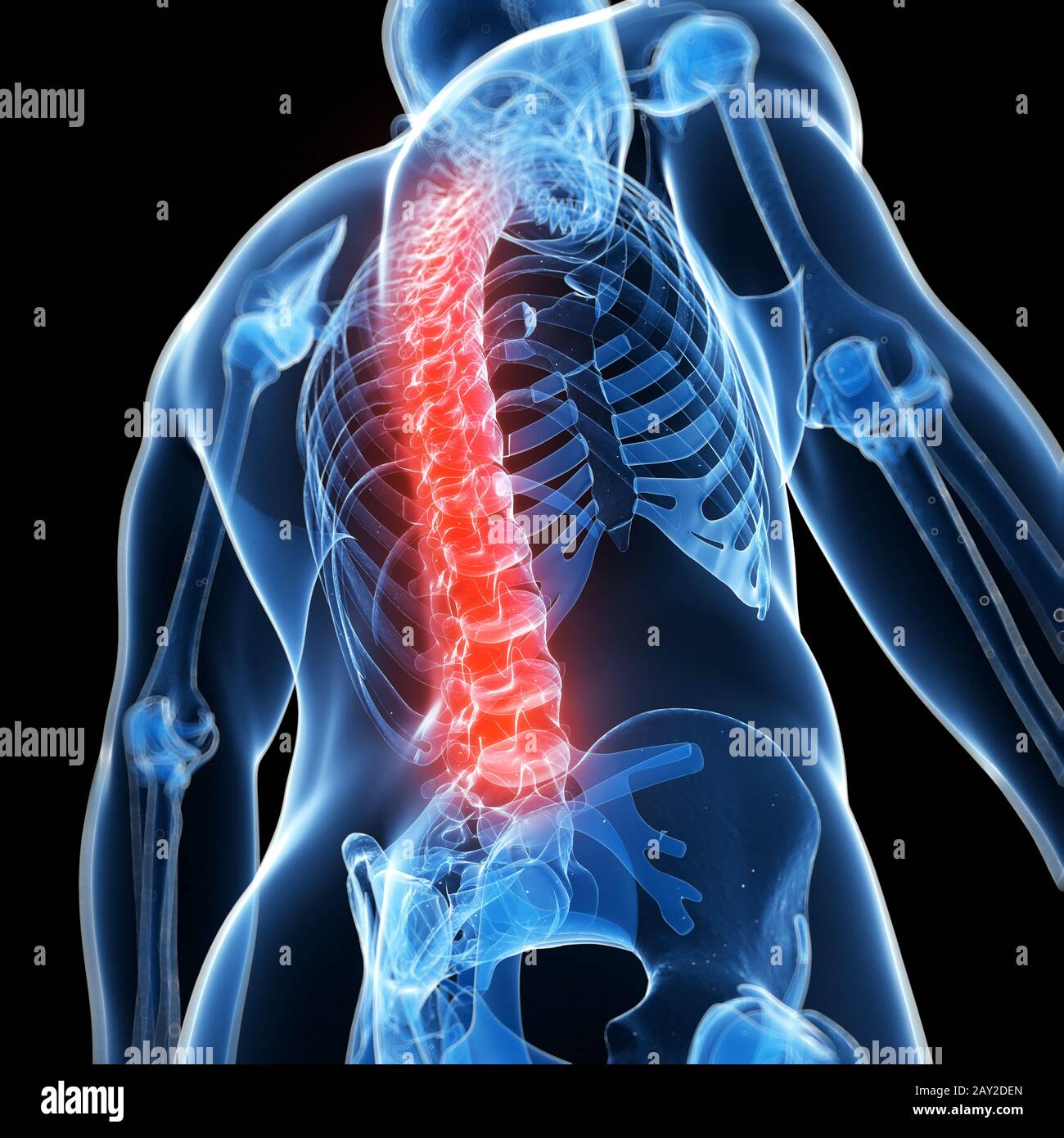 3d rendered illustration of a painful back Stock Photo - Alamy