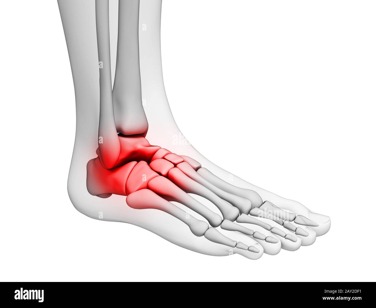 3d rendered illustration - painful ankle Stock Photo - Alamy