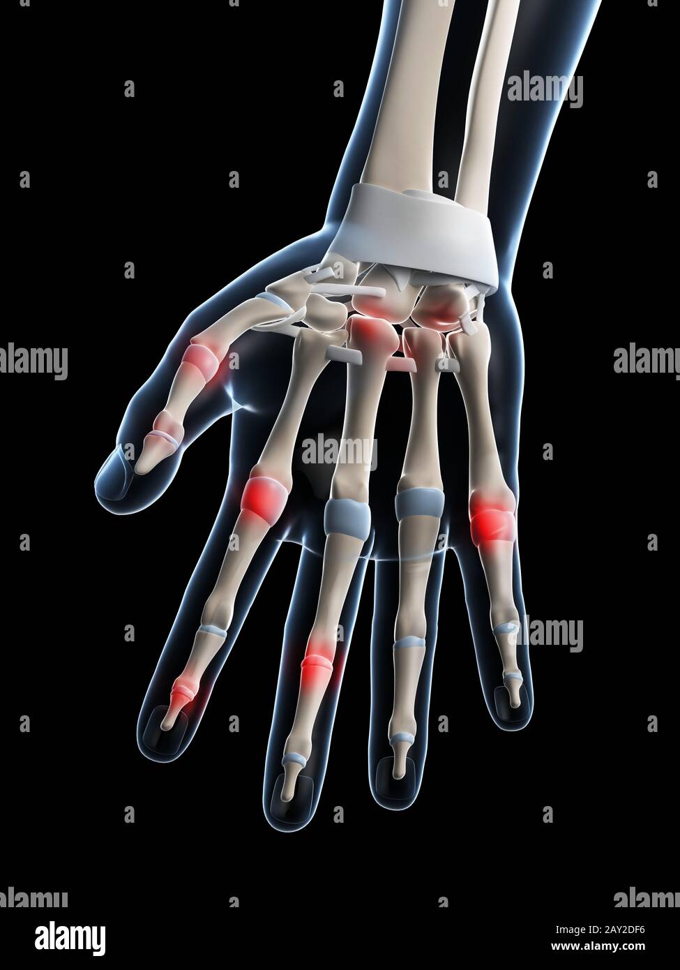 Hand joints illustration hi-res stock photography and images - Alamy