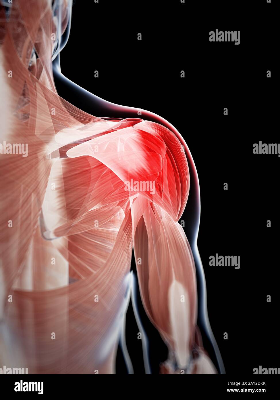 3d rendered illustration of a painful shoulder Stock Photo - Alamy