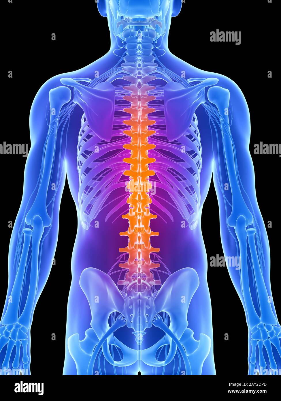3d rendered illustration - backache Stock Photo - Alamy