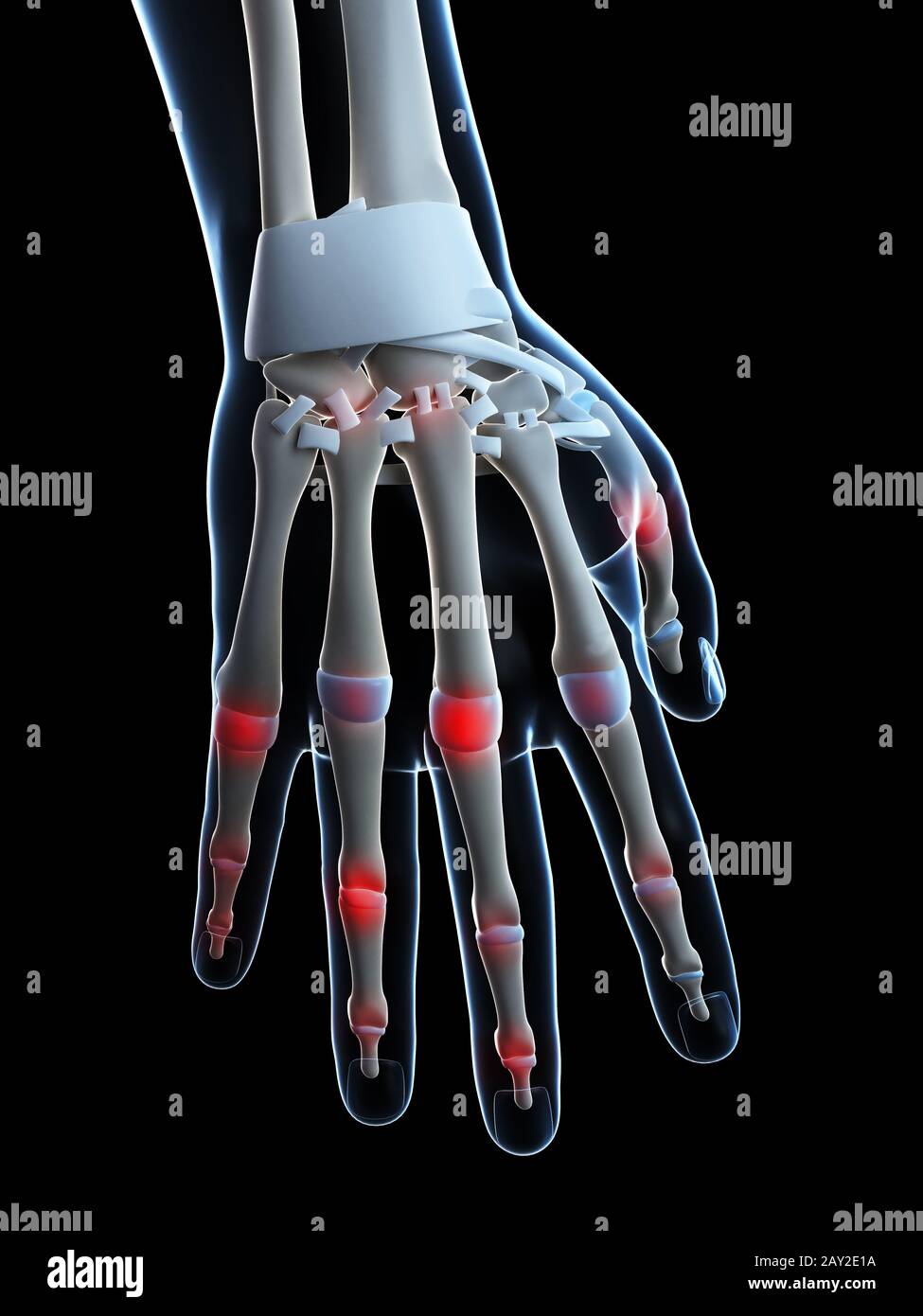 Metatarsal joint hi-res stock photography and images - Alamy