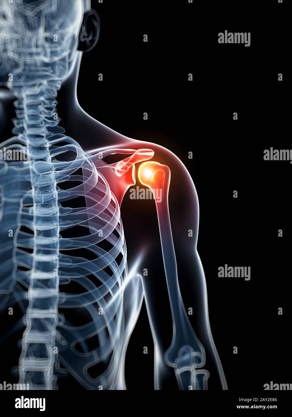 Shoulder problem hi-res stock photography and images - Alamy