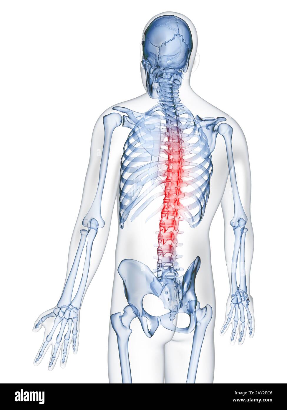 Spinal injury illustration Cut Out Stock Images & Pictures - Alamy