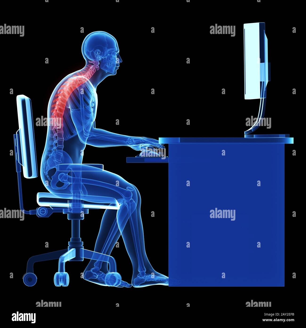 3d rendered medical illustration - wrong sitting posture Stock Photo ...