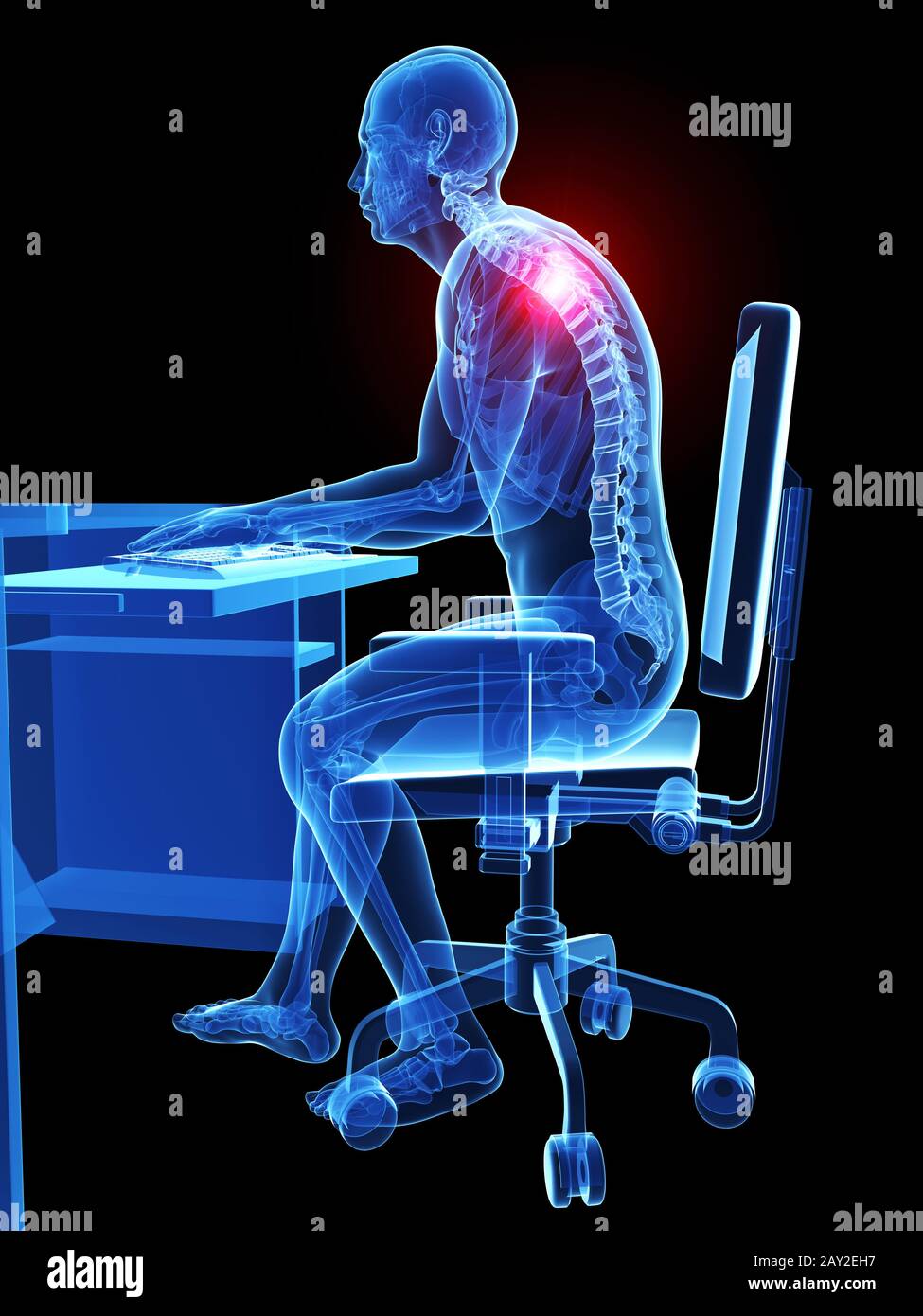 Wrong sitting posture hi-res stock photography and images - Alamy