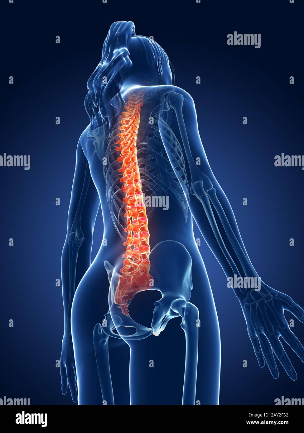 Painful spine hi-res stock photography and images - Alamy