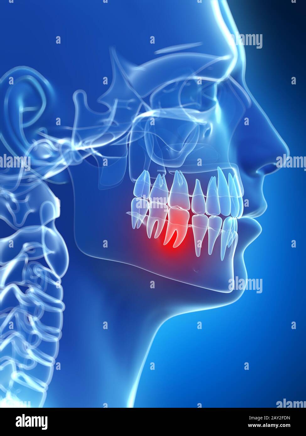 Human tooth pain illustration hi-res stock photography and images - Alamy