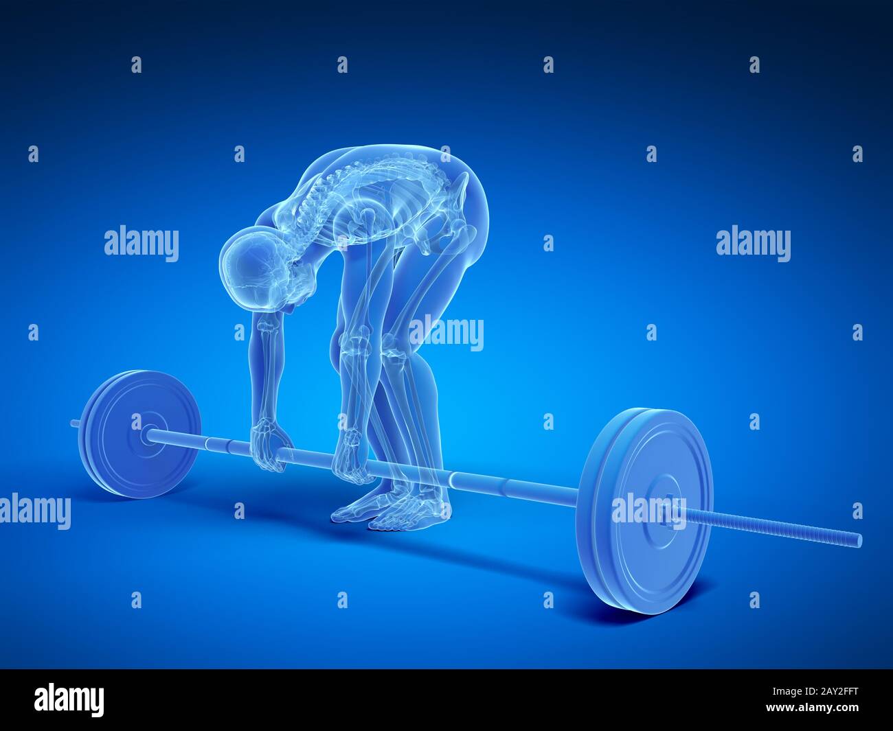 3d rendered medical illustration - wrong lifting posture Stock Photo ...